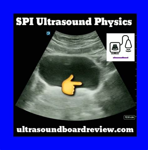 Beam Width Artifact Ultrasound Physics Physics Ultrasound