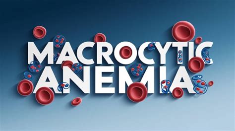 Pernicious Anemia Causes Symptoms Diagnosis And Treatments