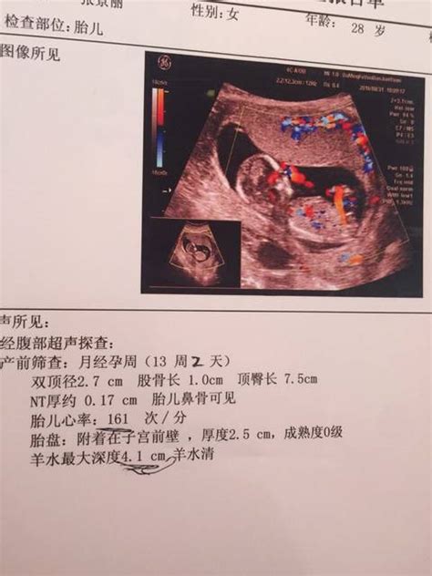 B超怎么看男女宝宝曹云金宝宝b超照 随意云