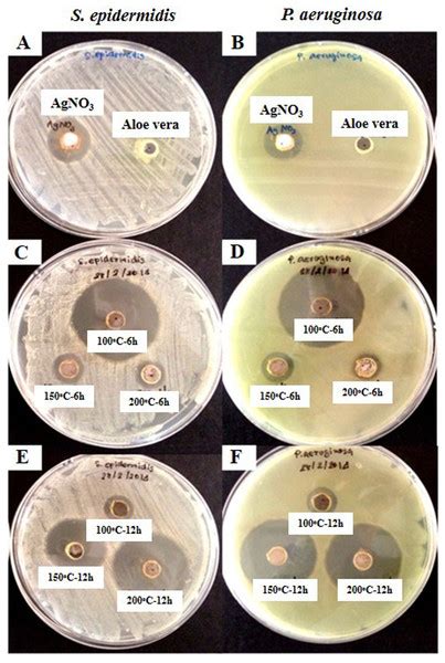 Green Synthesis Of Silver Nanoparticles In Aloe Vera Plant Extract Prepared By A Hydrothermal