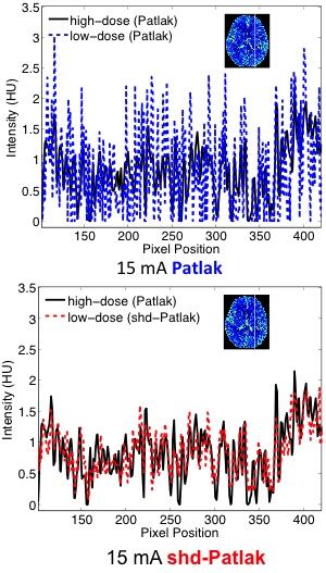 Sparsity High Dose Induced Patlak Model