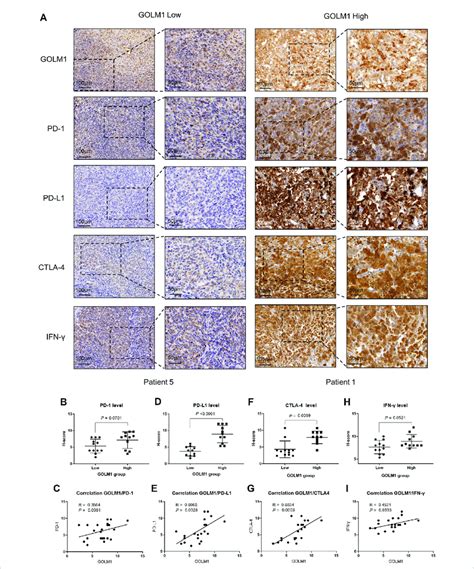 Correlation between GOLM expression and PD PD L CTLA and IFN γ Download Scientific
