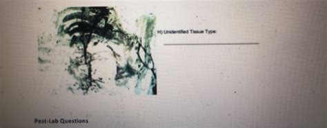 Solved Experiment 1 Microscopic Slide Examination Of Tissue