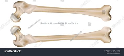 Types Bone Fracture Structure Bone Vector Stock Vector Royalty Free Shutterstock