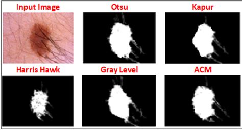 Figure 1 From Skin Lesion Segmentation Using An Ensemble Of Different