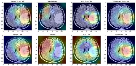 Github Johnnys7nmulticlass Brain Detection Tool Predicting Age Of The Subject Based On White