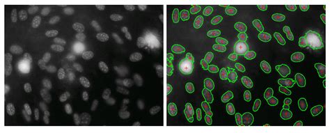 生物图像处理软件细胞分割 Csdn博客