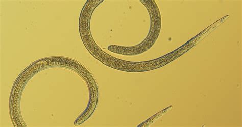 Parasite Of The Day Trichinella Britovi
