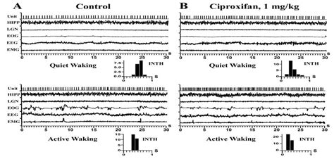 Representative Example Of The Effect Of Ciproxifan 1 Mgkg Im On The