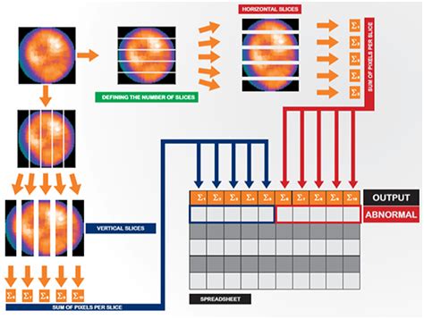 Frontiers Machine Learning Algorithms To Distinguish Myocardial Perfusion Spect Polar Maps