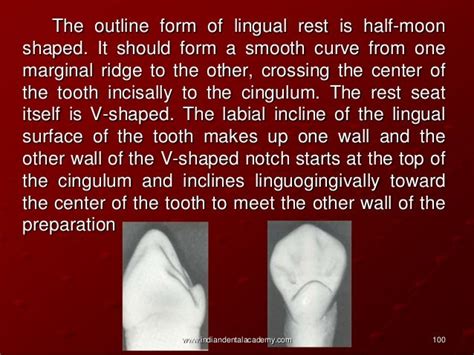 Mouth Preparation For Rpd Certified Fixed Orthodontic Courses By Ind…