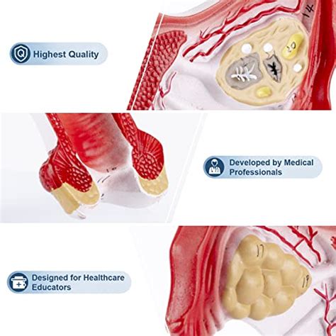Winyousk Life Size Uterus And Ovary Model Anatomical Model Of Female