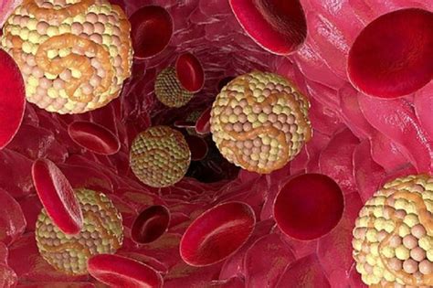 Кои се раните симптоми на висок холестерол најчесто се јавуваат ноќе Реален Медиум за Реални