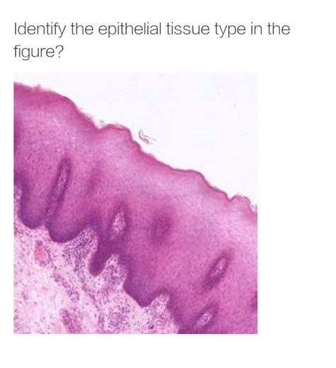 Answered Identify The Epithelial Tissue Type In Bartleby