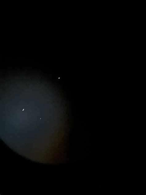 Help With Focus R Telescopes