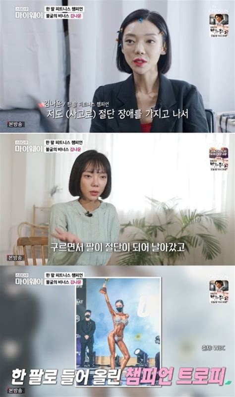 김나윤 오토바이 사고로 왼팔 절단경추부터 흉추까지 19군데 골절 아시아경제