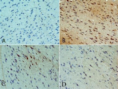Representative Photomicrographs Of Tnf α Immunohistochemistry Of Brain Download Scientific