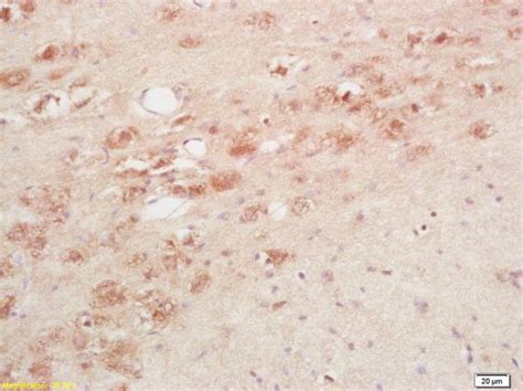 Thyrotropin Releasing Hormone TRH 抗体 Abcam中文官网