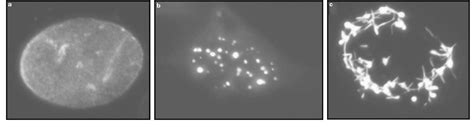 Figure 2 From Variants Of The Lamin A C Lmna Gene In Non Valvular