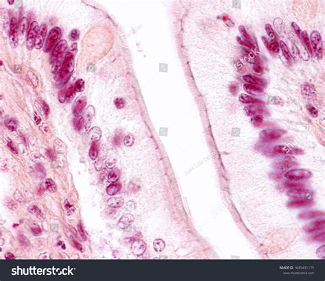 Small Intestine Columnar Epithelium Lpo Mag By Spyrog Vrogue Co