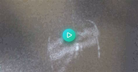 Slice By Slice Scan Of A Human Brain Using An Fmri Machine Album On Imgur