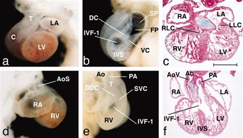 Embryo At 9 Days 15 Hr C Shaped Looped Heart A B Frontal Views Of