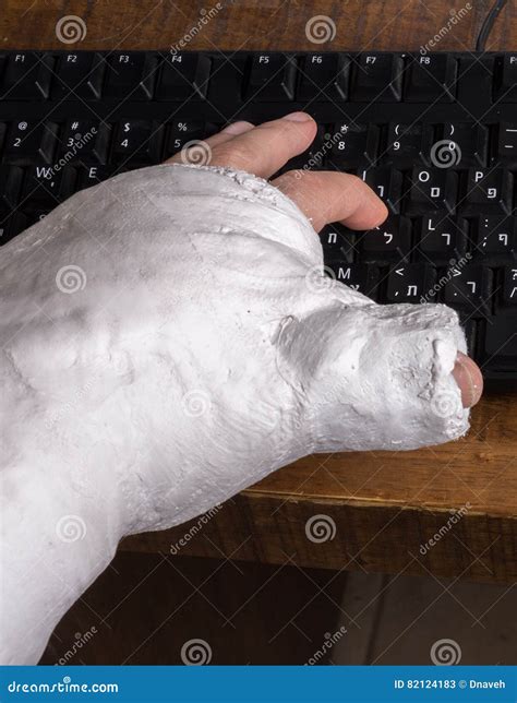 Person With Arm Cast Typing On A Keyboard Stock Image Image Of Hebrew