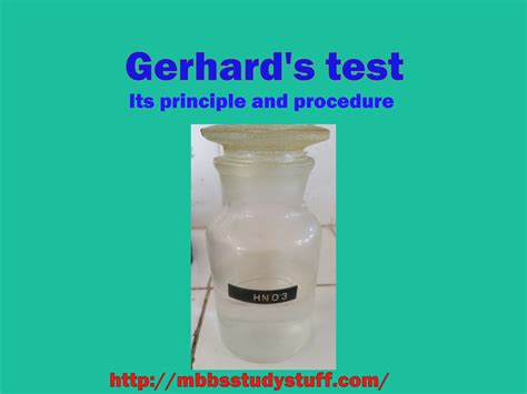 Rothera S Test By Nitroprusside Reaction Its Principle And Procedure
