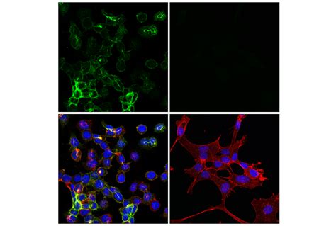 Gap43 E1u1d Mouse Mab Cell Signaling Technology