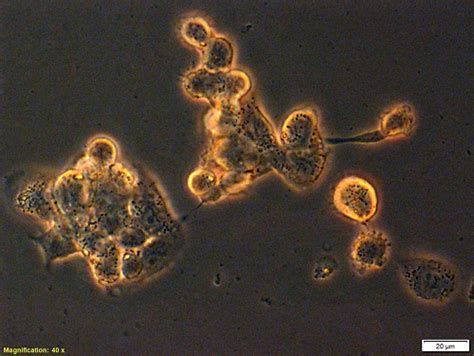 Why Do My Pma Treated Thp1 Cells Have Black Dots Researchgate
