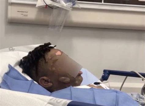 더쿠 장난으로 자는 친구 얼굴에 뜨거운 물 부은 무서운 美 대들