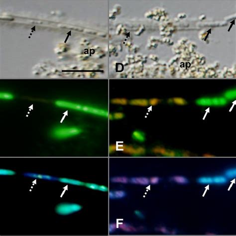 Pdf Autolysis Of Bacterial Cells Leads To Formation Of Empty Sheaths