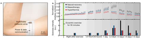 Serial Monitoring Of Deep Tissue Stiffness Using Wearable Ultrasound
