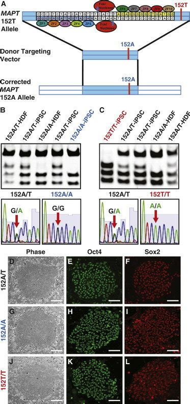 Generation Of Isogenic Human Tau A152t Ipsc Lines With Zfn Mediated