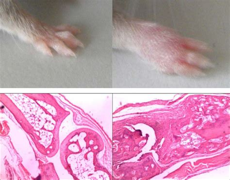 Histologic Analysis In The Joints Of Hind Limbs In Mice With Cia A