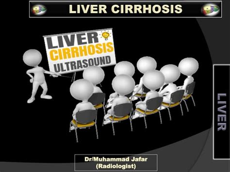 Liver Cirrhosis Ppt