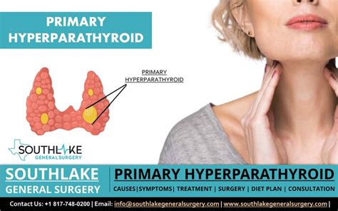 Hyperparathyroidism Testimonial Hyperparathyroidism S