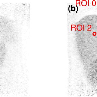 Regions Of Interest Used For Quantitative Analysis A Bulk Motion