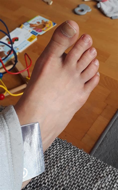 My Sweet Toes Rnopolishtoes