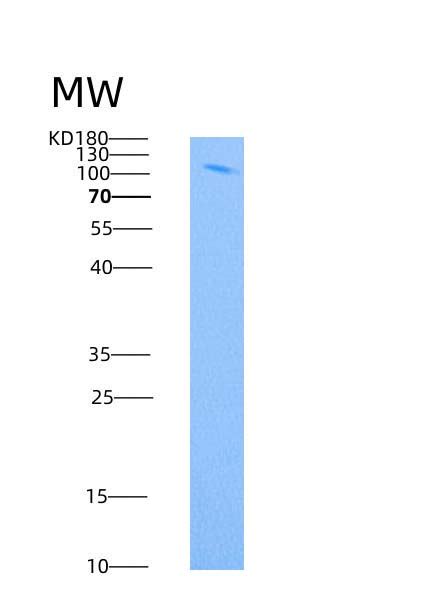 Recombinant Human Leptin Receptor Lepr Cd295 Protein His And Fc Tag