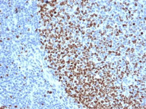 Recombinant Ki 67 Proliferating Cell Marker Antibody Clone Rmki67