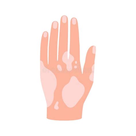 Pigmentation Vector Stock Illustrations 1726 Pigmentation Vector