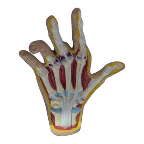 Osteoarthritis Hand Model Model Of Hand Pathology Human Anatomy And
