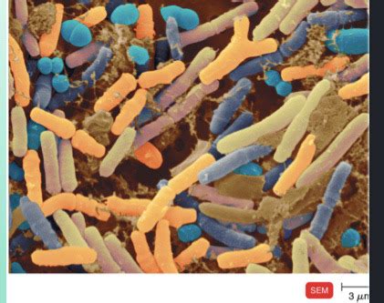 MicroBiology Chapter Intro To The Microbial World Flashcards Quizlet