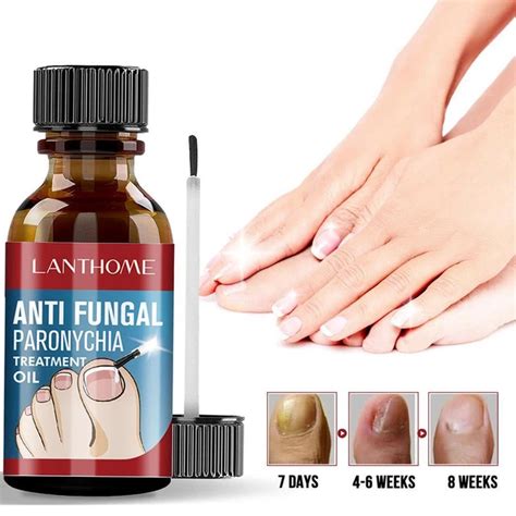 Best German Toenailplus Nailprop Anti Paronychia Relief Oil N E W 20 23