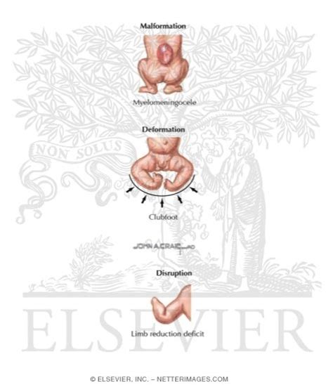 Errors In Morphogenesis