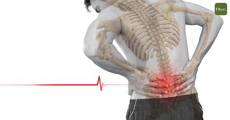 下背痛是什麼原因造成？醫師詳解下背痛原因、症狀、改善方法 Heho健康