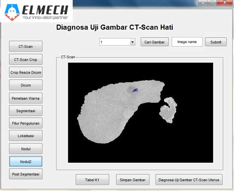 Jasa Pemrograman Matlab Untuk Image Processing Artificial Intelligence
