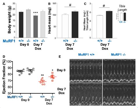 Murf1 −− Mice Are Protected From Doxorubicin Dox Induced Cardiac