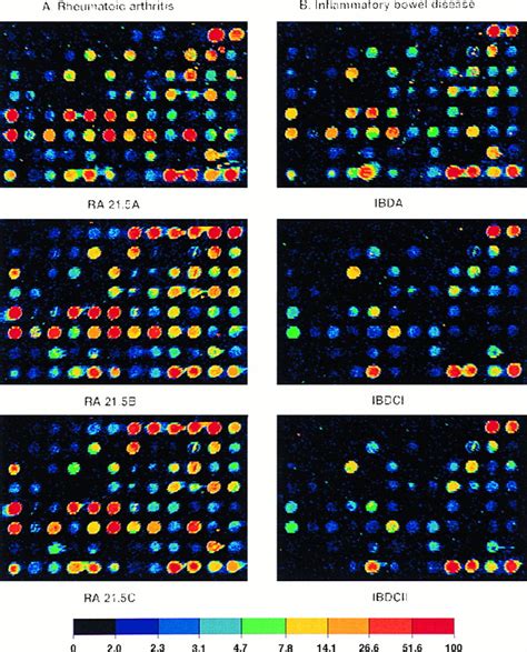 Discovery And Analysis Of Inflammatory Disease Related Genes Using Cdna Microarrays Pnas